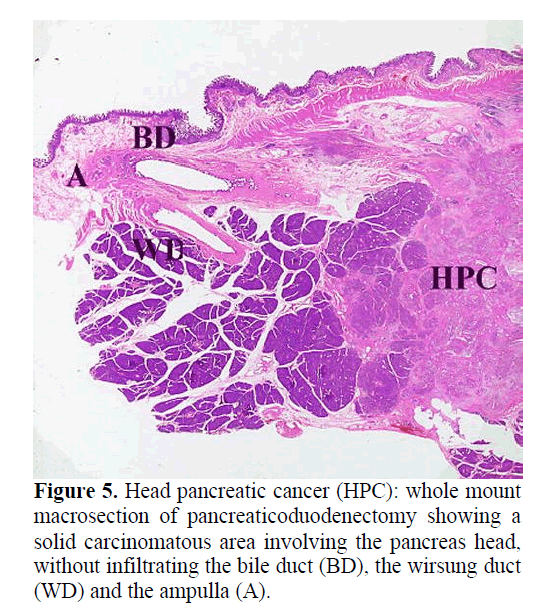 Pancreatic Head Mass What Can Be Done Classification The Patho Pancreatic Head Mass What Can Be Done Classification The Patho