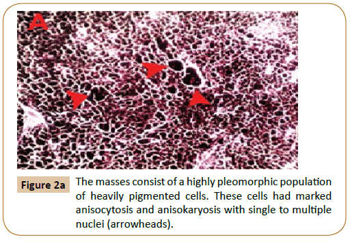 Diagnosis and Management of a Malignant Dermal Melanoma in a Don